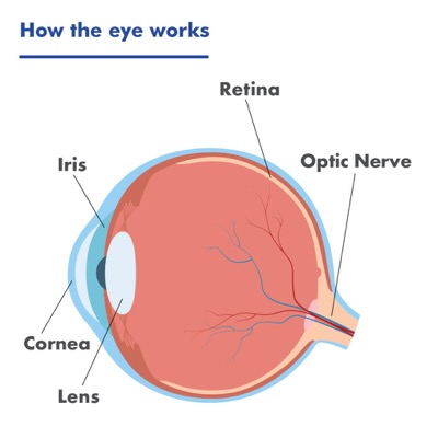About macular disease - Macular Disease Foundation Australia